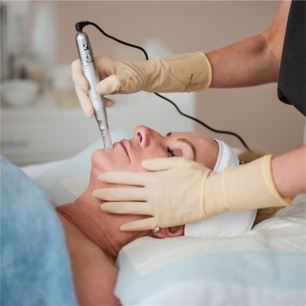 Kausmedi Corded Skin Needling Pen - Salon First Beauty Supplies - Salon ...